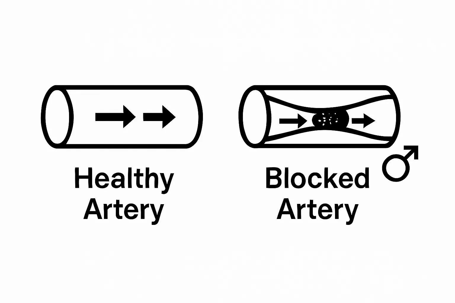 Understanding the Connection Between Monitoring Cholesterol and ED ...