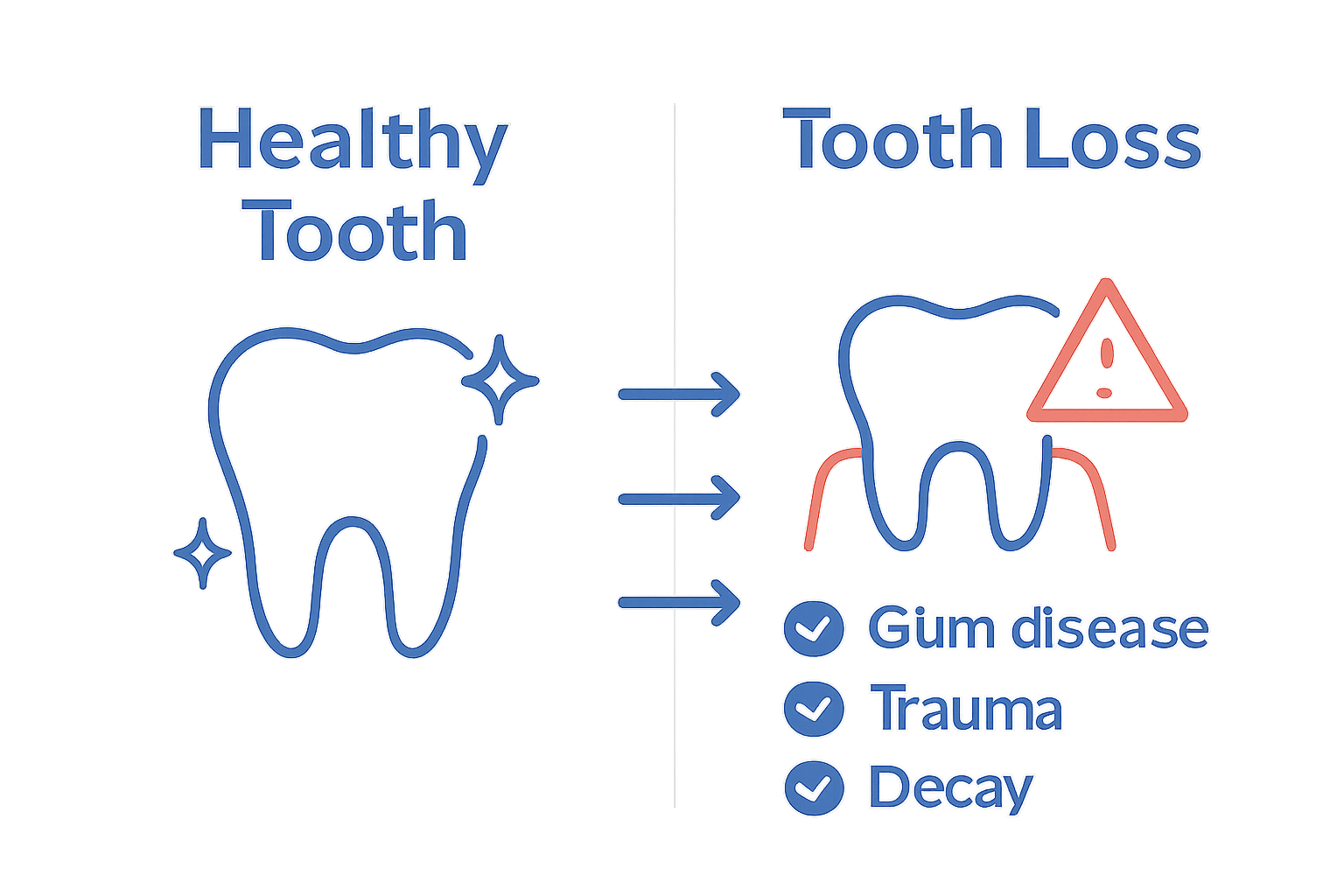 Understanding What Causes Tooth Loss: Key Insights Revealed - Arvada ...