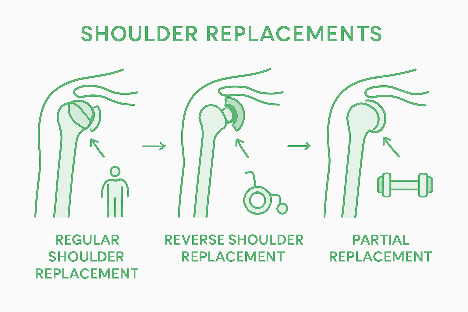 Shoulder Joint Replacement: Life After Surgery in Austin - Austin Hand ...